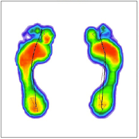Revolutionary Rectifier for Body Symmetry