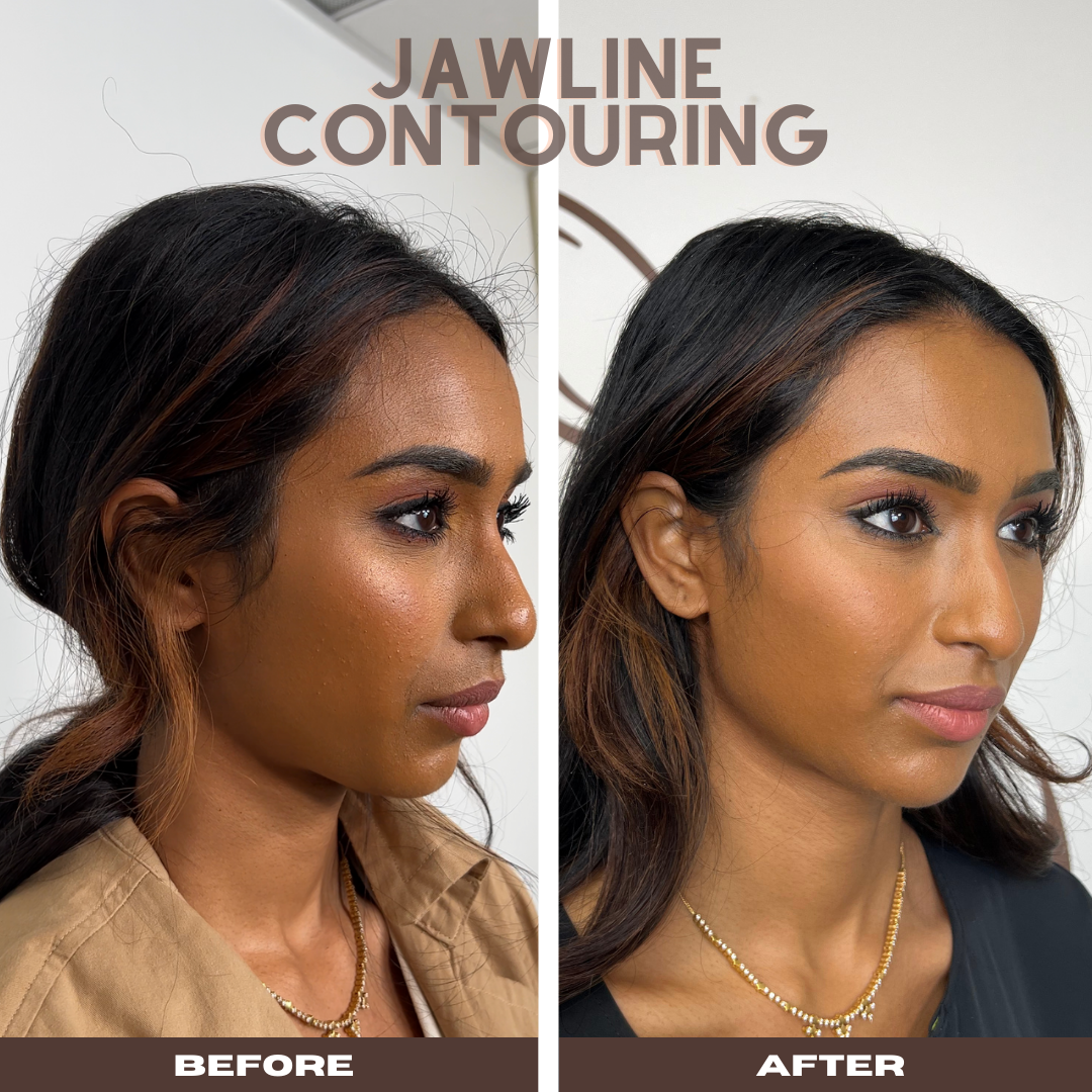 Receive a $100 Towards Your Lip Injections!